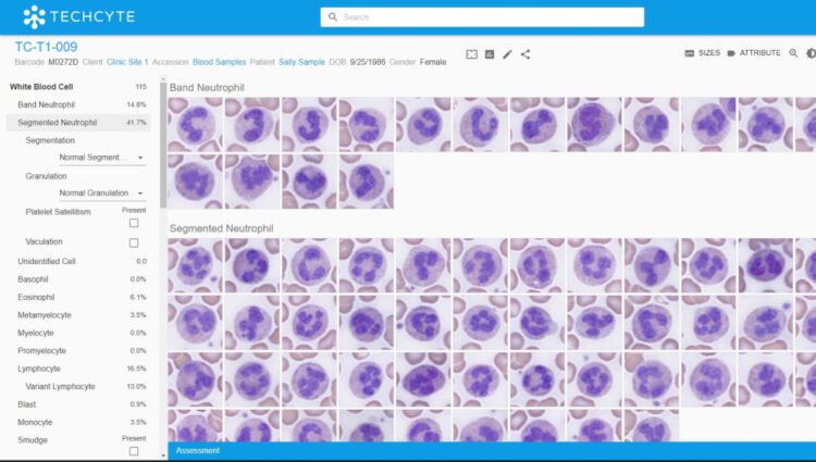 Fusion Hematology Suite | Techcyte